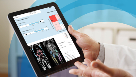 AMRA® Profiler 4 Pilot Study Demonstrates Feasible Assessment of Muscle ...