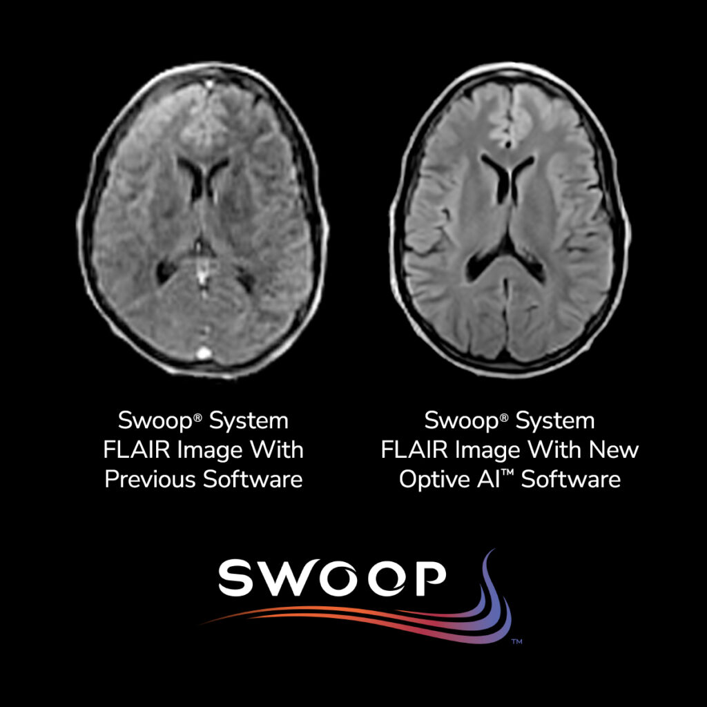 Hyperfine Receives FDA Clearance for Optive AI™, Marking Major Leap in ...