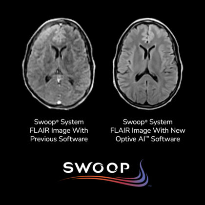 Hyperfine Receives FDA Clearance for Optive AI™, Marking Major Leap in ...