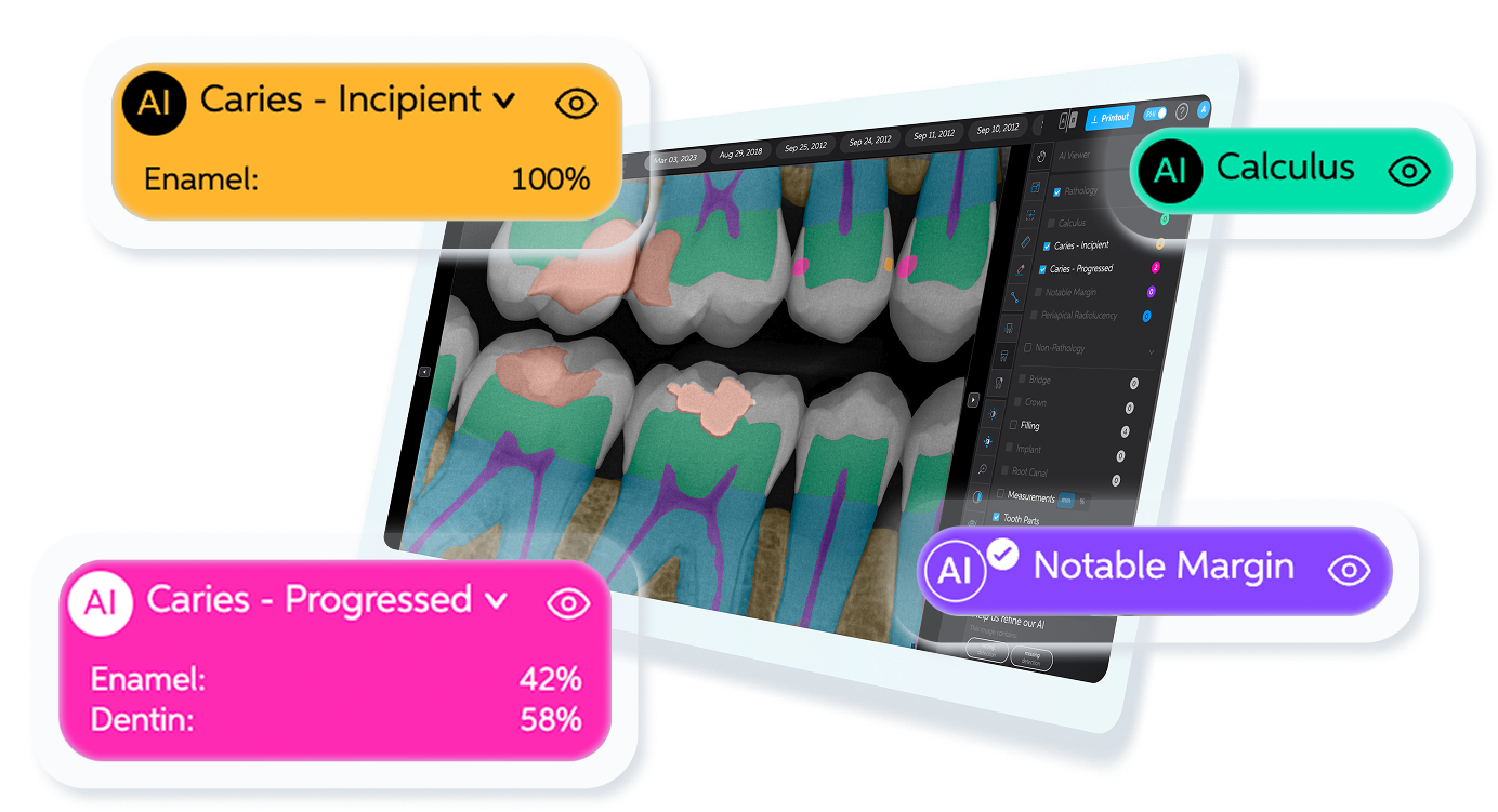 Dentsply Sirona and Pearl Partner to Integrate AI Radiologic Support ...
