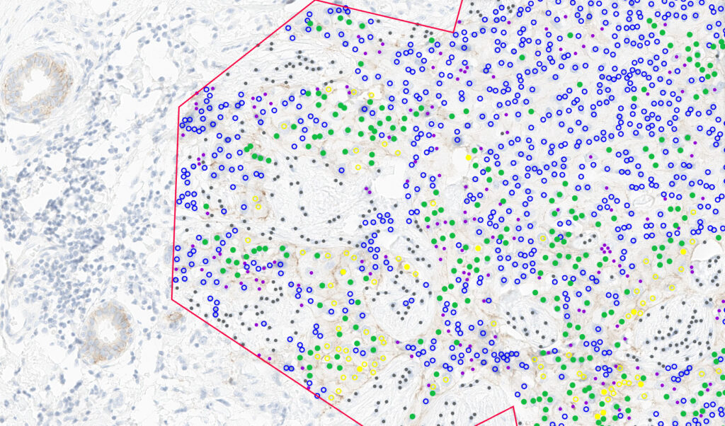 Ibex Medical Analytics Earns IVDR Certification for AI-Powered HER2 ...