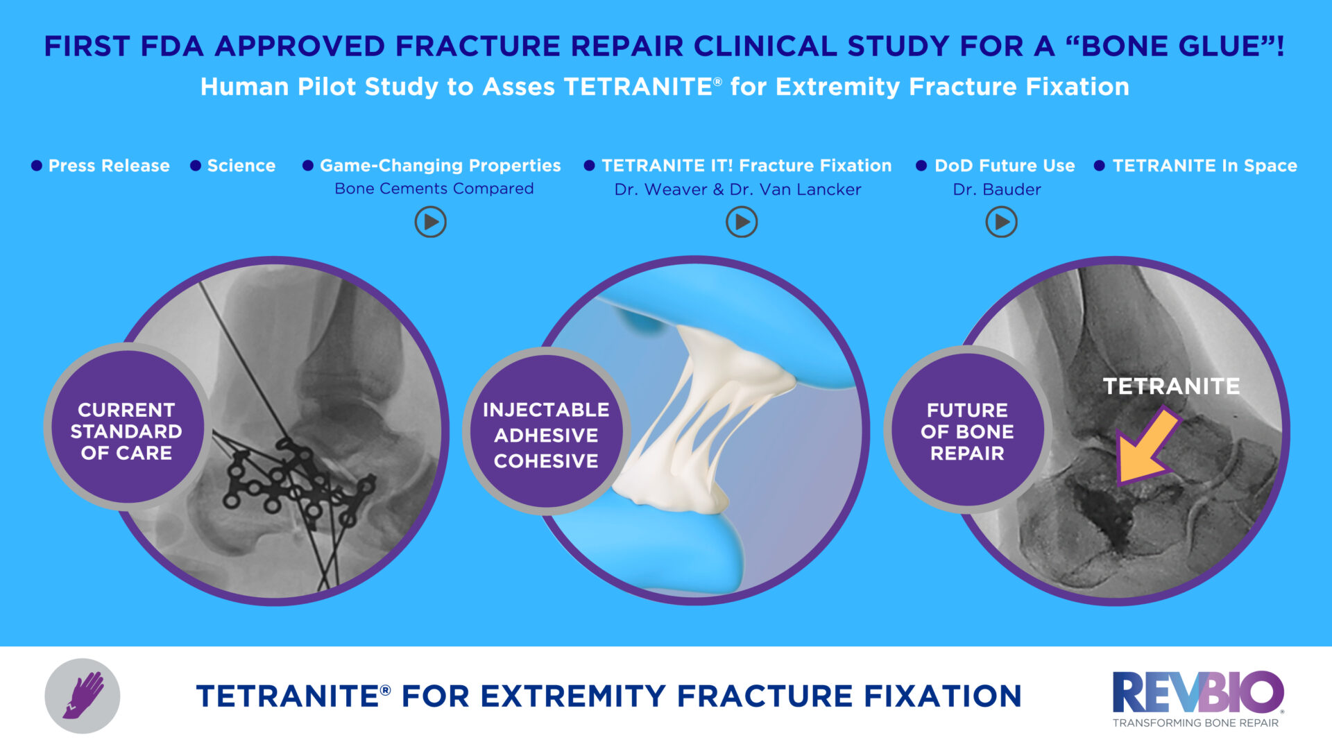RevBio Receives FDA Approval for First Clinical Trial of TETRANITE Bone ...